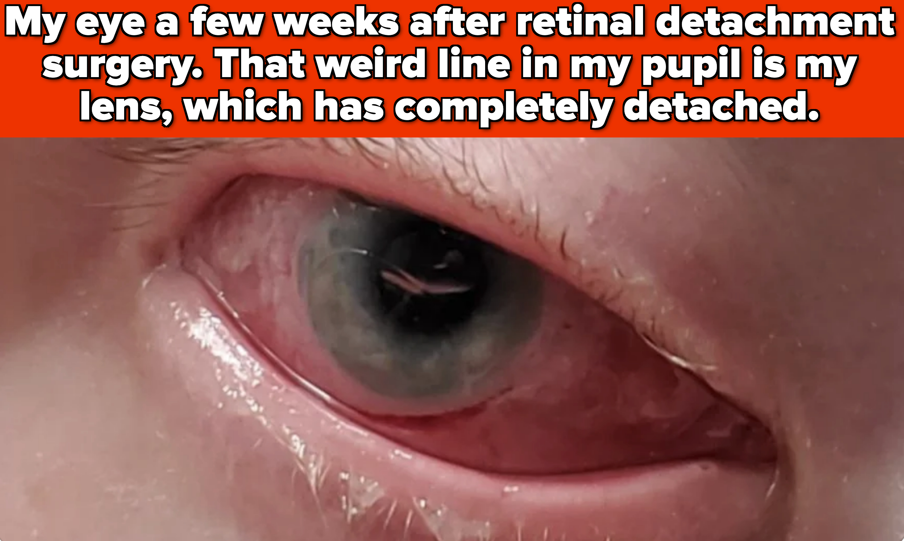 51 Absolutely Fascinating Photos Of The Human Body