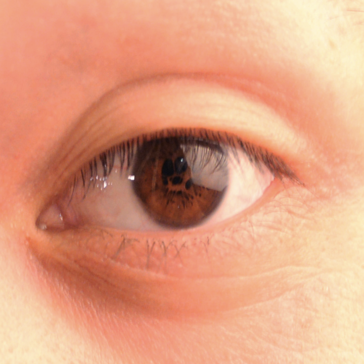 21 People With Rare Human Body Medical Mysteries