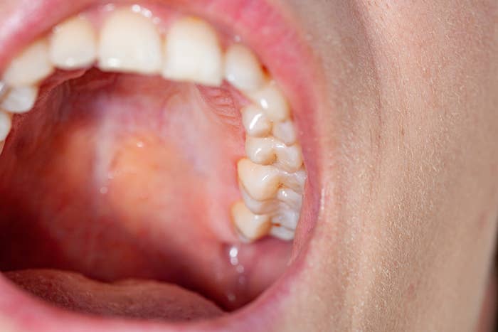 21 People With Rare Human Body Medical Mysteries