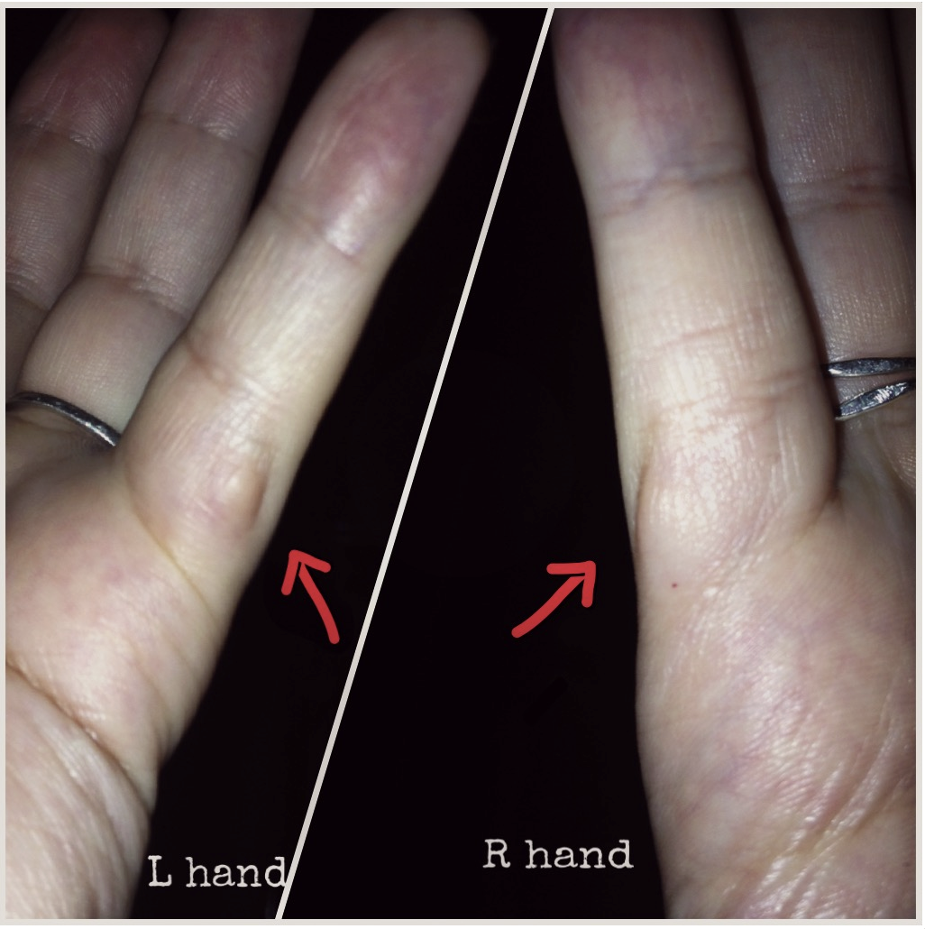 21 People With Rare Human Body Medical Mysteries