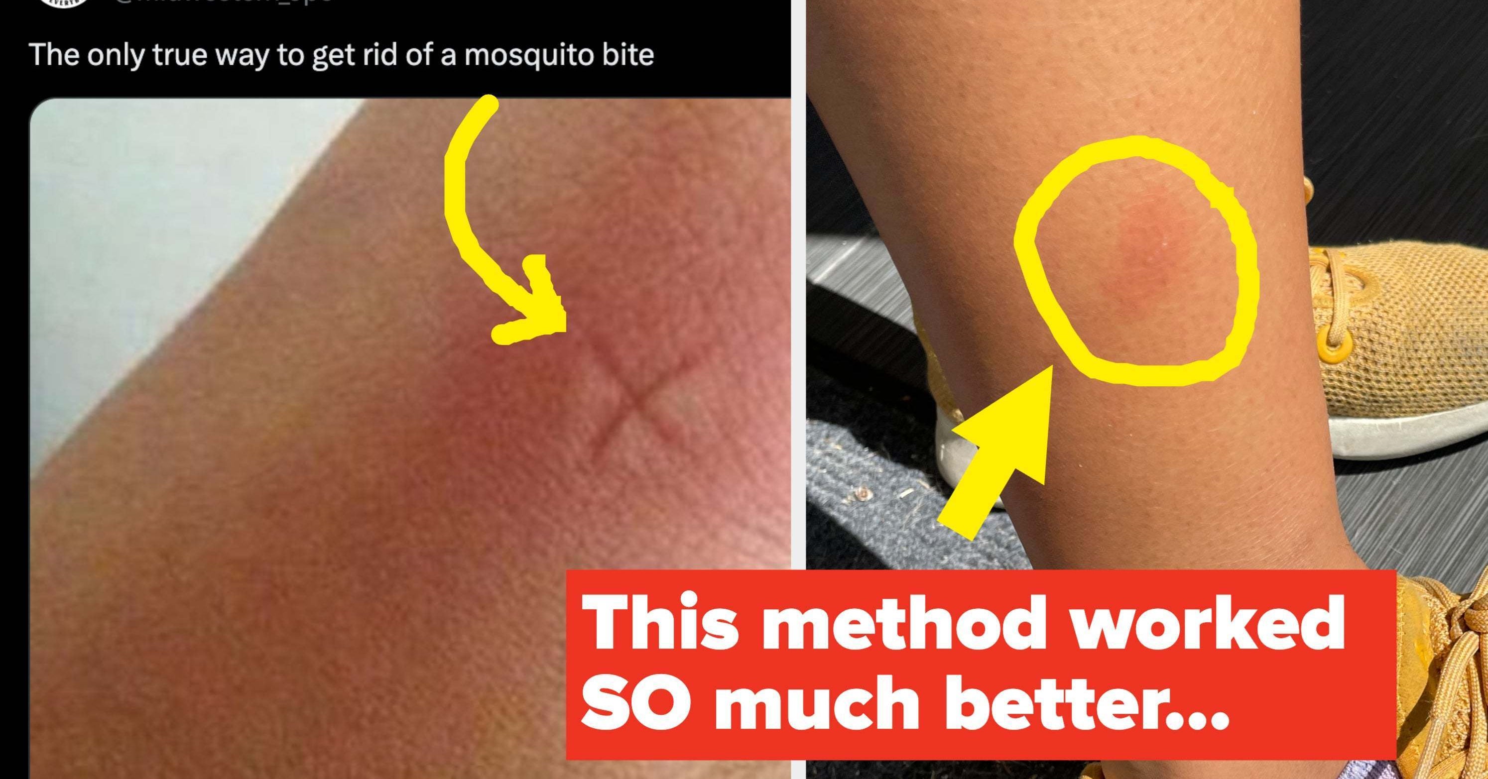 Best Mosquito Bite Relief And Prevention, Tested
