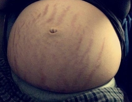 33 Unfiltered Pregnancy Photos Of What It's Really Like