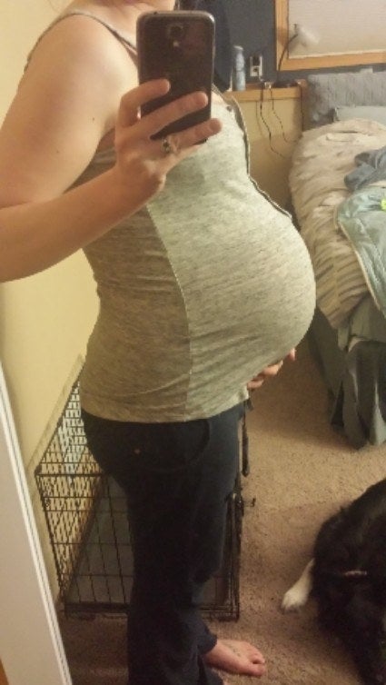 33 Unfiltered Pregnancy Photos Of What It's Really Like