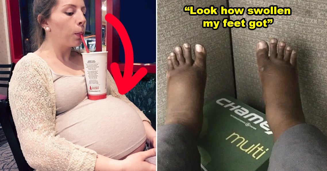 33 Unfiltered Pregnancy Photos Of What It's Really Like