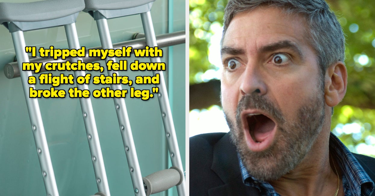 People Are Sharing Their Dumbest Injuries