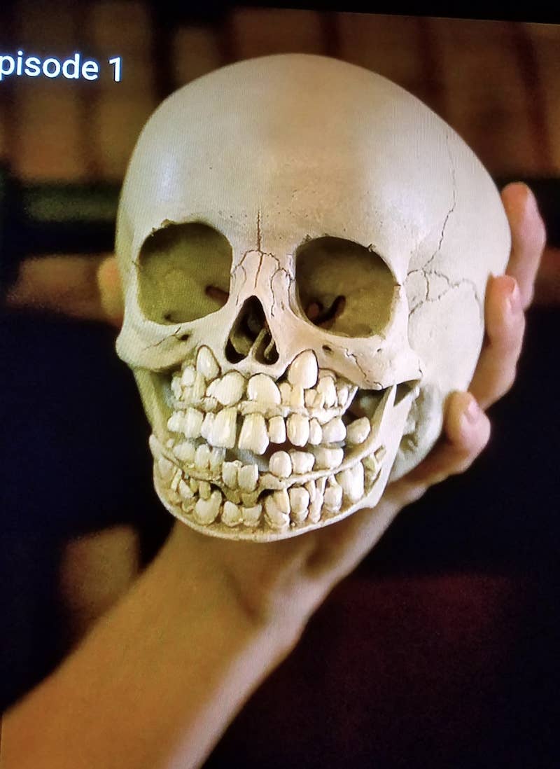 human skull with extra teeth