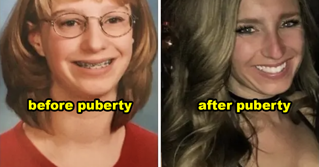 33 Puberty Glow-Up Transformation Pictures