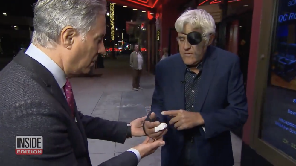 Jay Leno Showed Off His Injuries From Falling Down A 60-Foot Hill