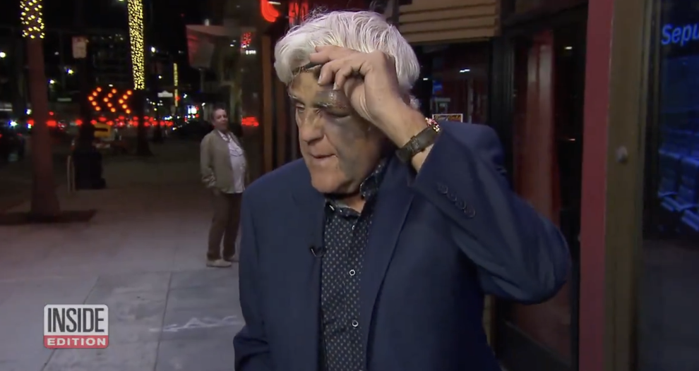 Jay Leno Showed Off His Injuries From Falling Down A 60-Foot Hill