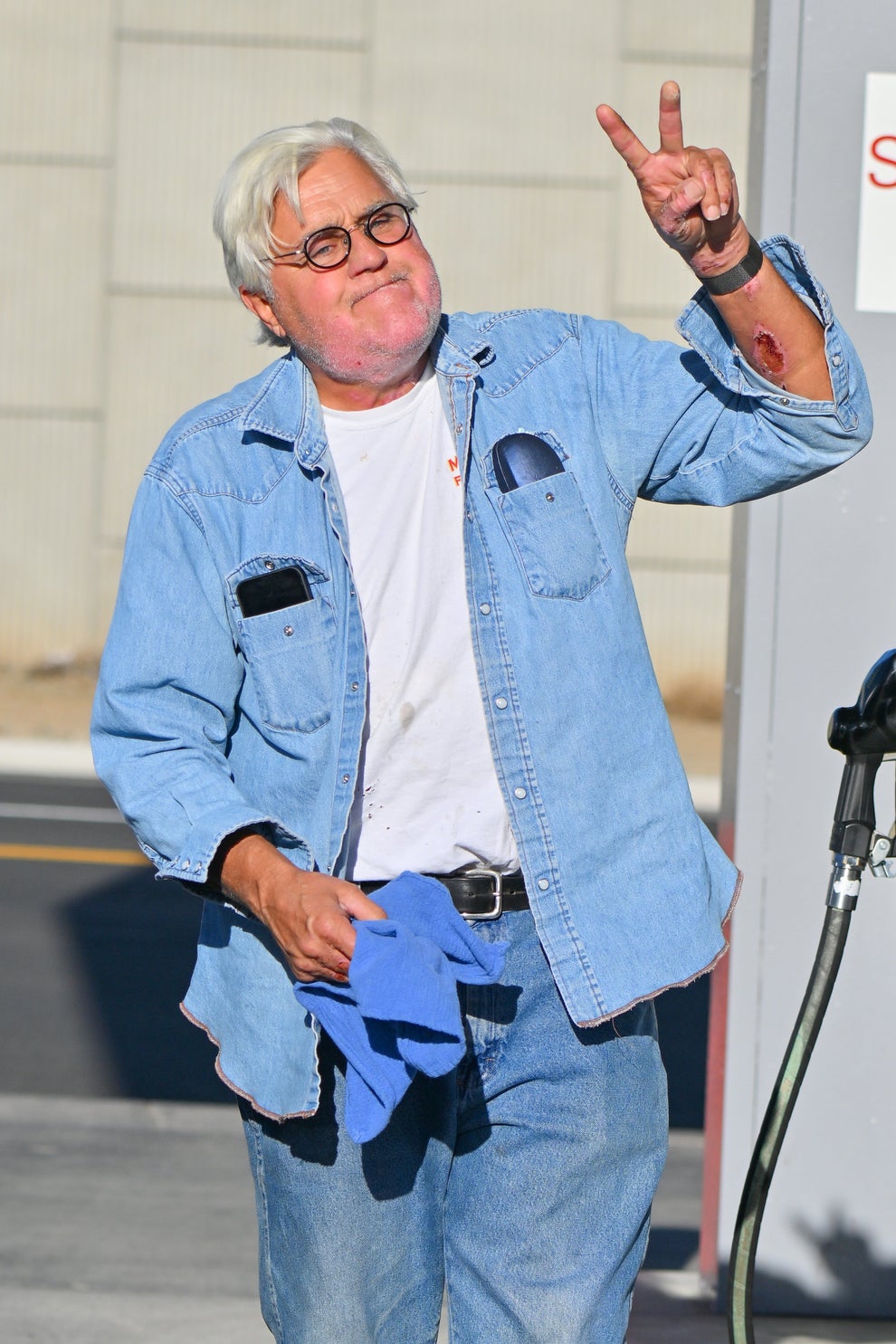 Jay Leno Showed Off His Injuries From Falling Down A 60-Foot Hill