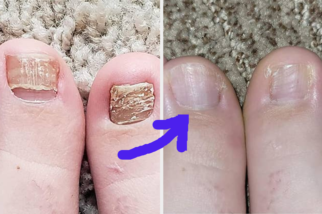 Stop Whining About Annoying Body Problems And Start Solving Them With ...