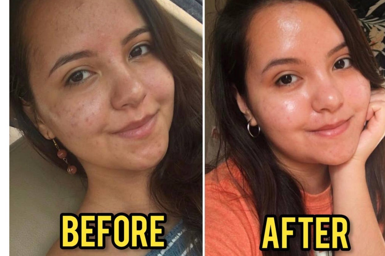 25 K-Beauty Products With Jaw-Dropping Result Photos