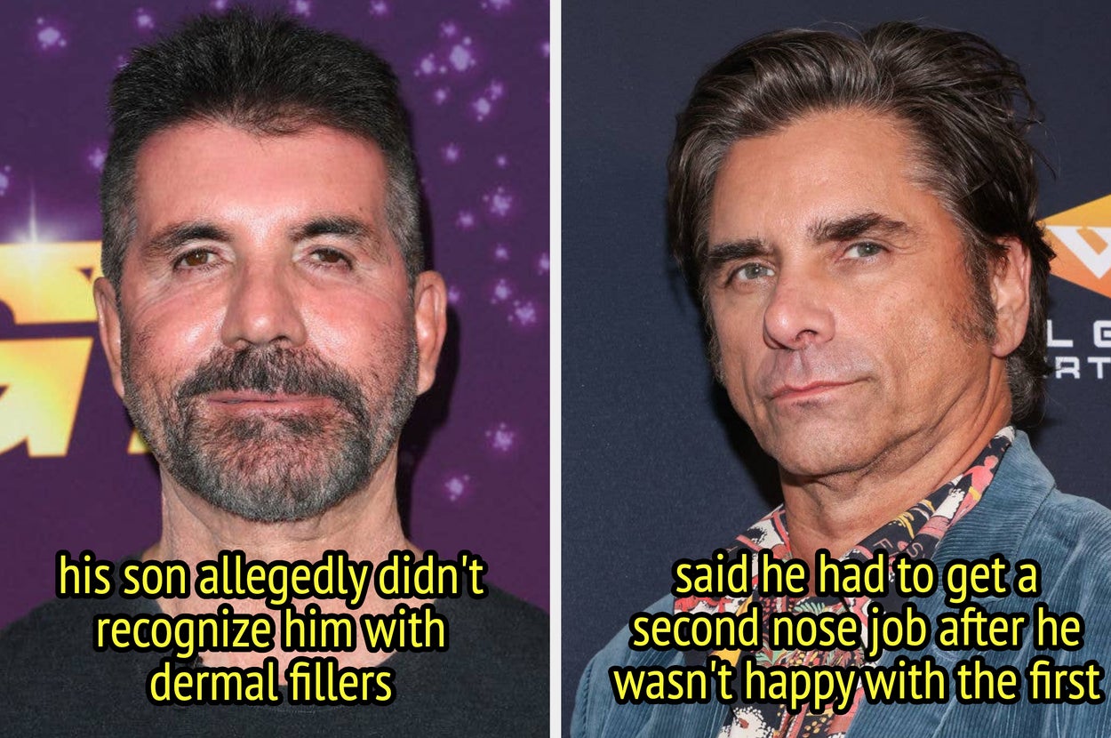 plastic surgery guy face