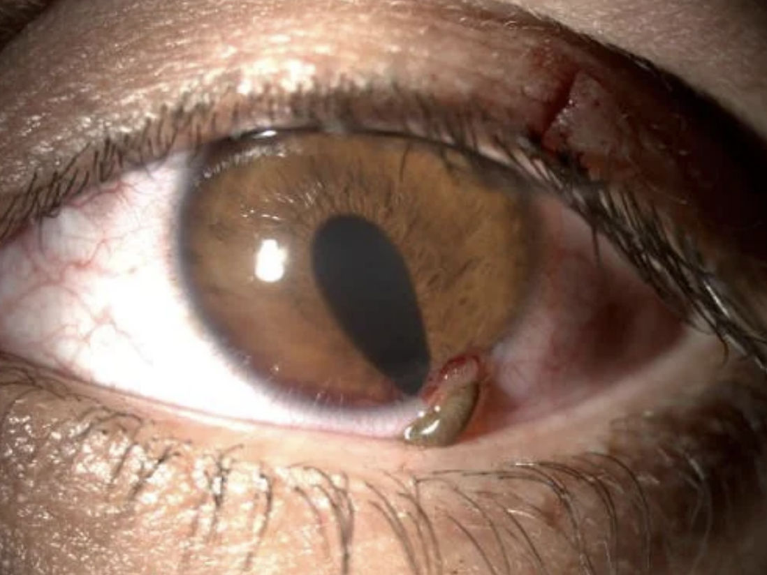 48 Fascinating Photos Of The Human Body