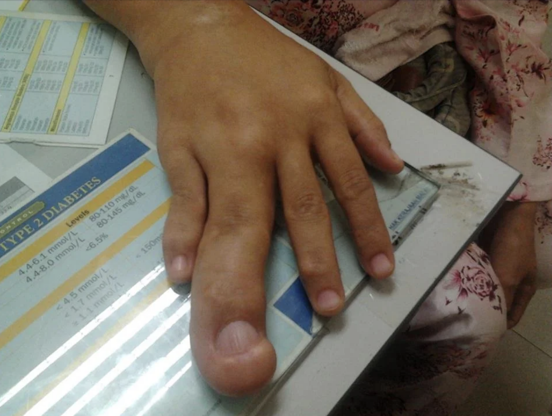 48 Fascinating Photos Of The Human Body