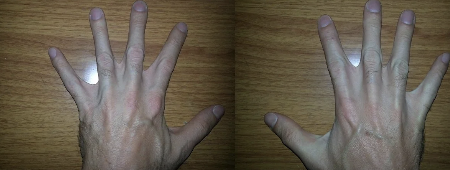 48 Fascinating Photos Of The Human Body