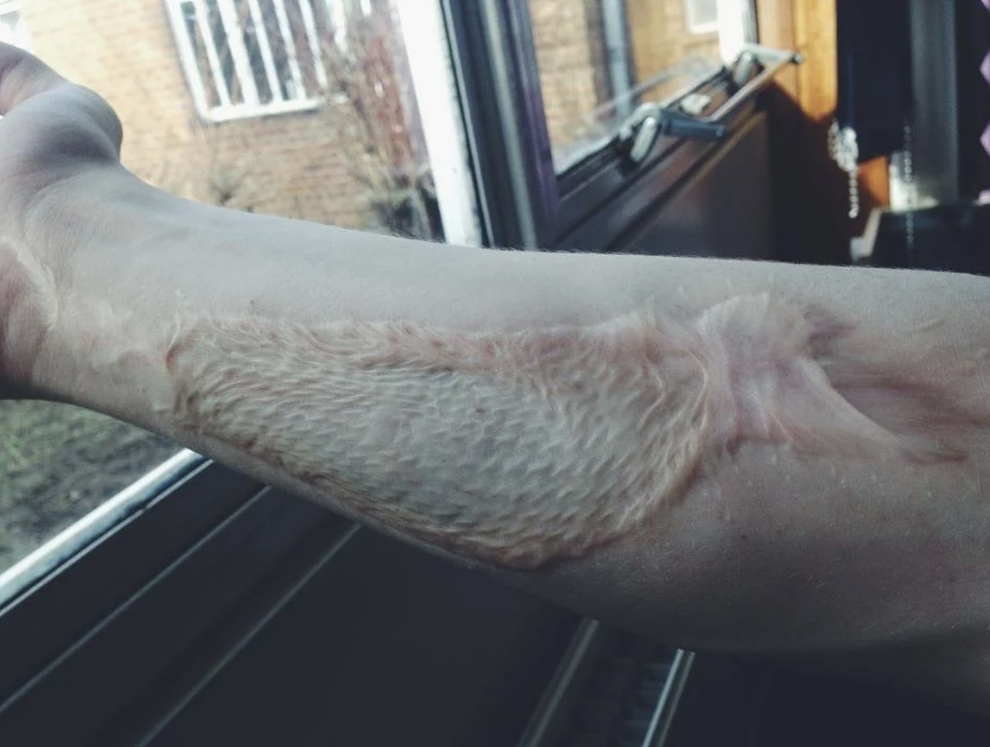 48 Fascinating Photos Of The Human Body