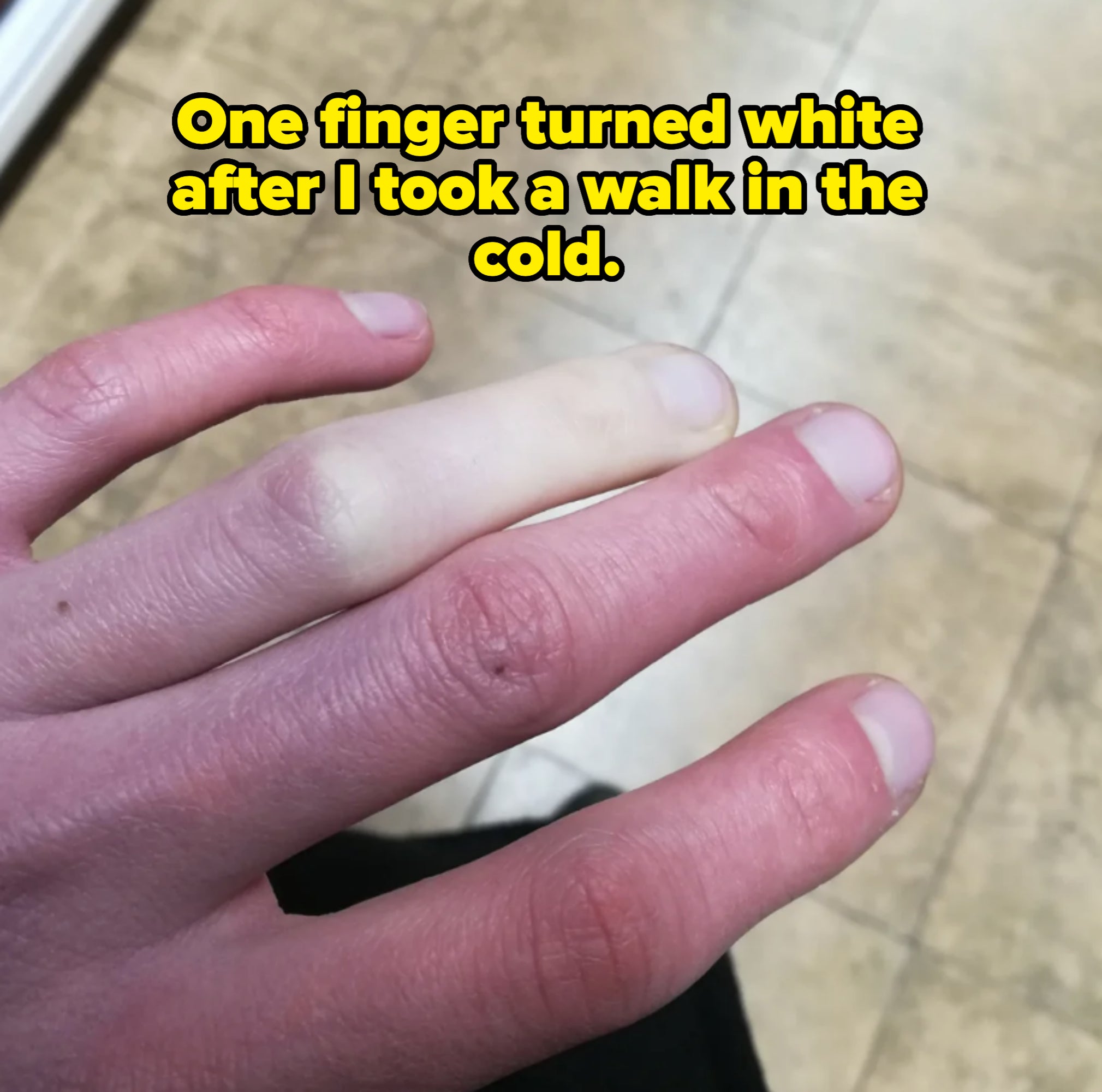 48 Fascinating Photos Of The Human Body