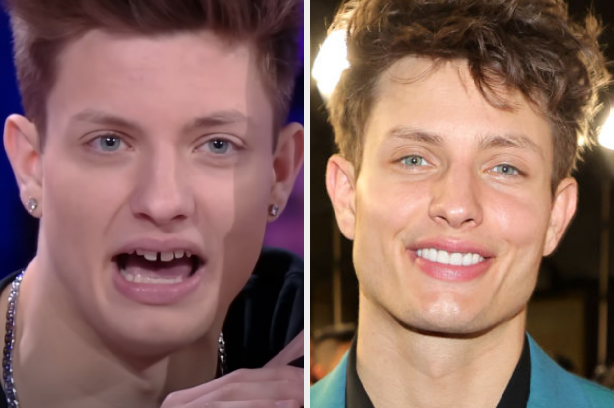 Matt Rife Responds To Plastic Surgery Rumors