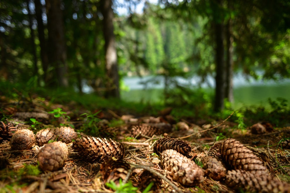 31 Clumsy People Share Their Funniest Injury Stories