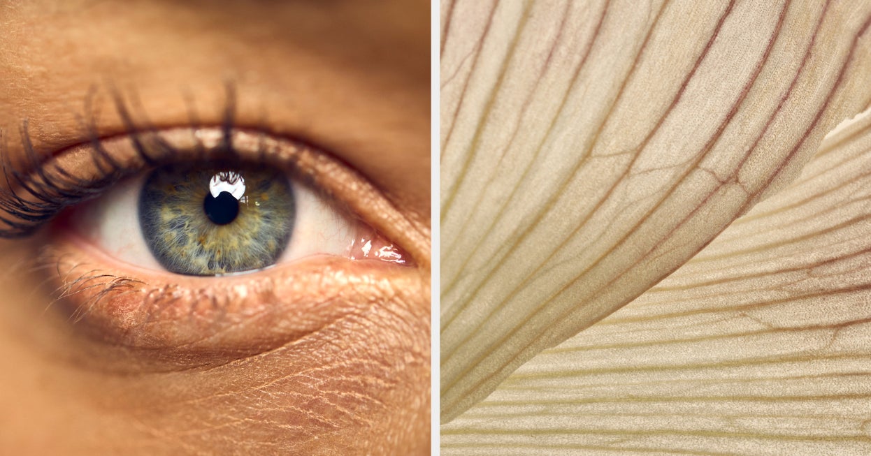 Zoomed-In Image Vision Test