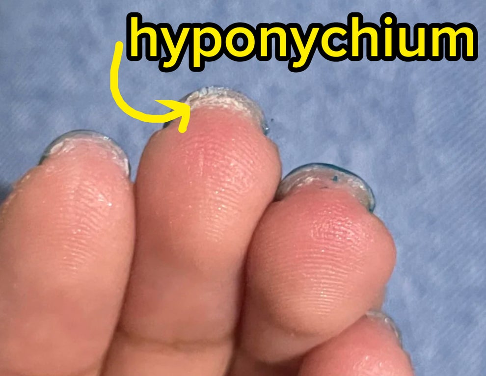 34 Unusual Body Things People Didn't Know Weren't Normal