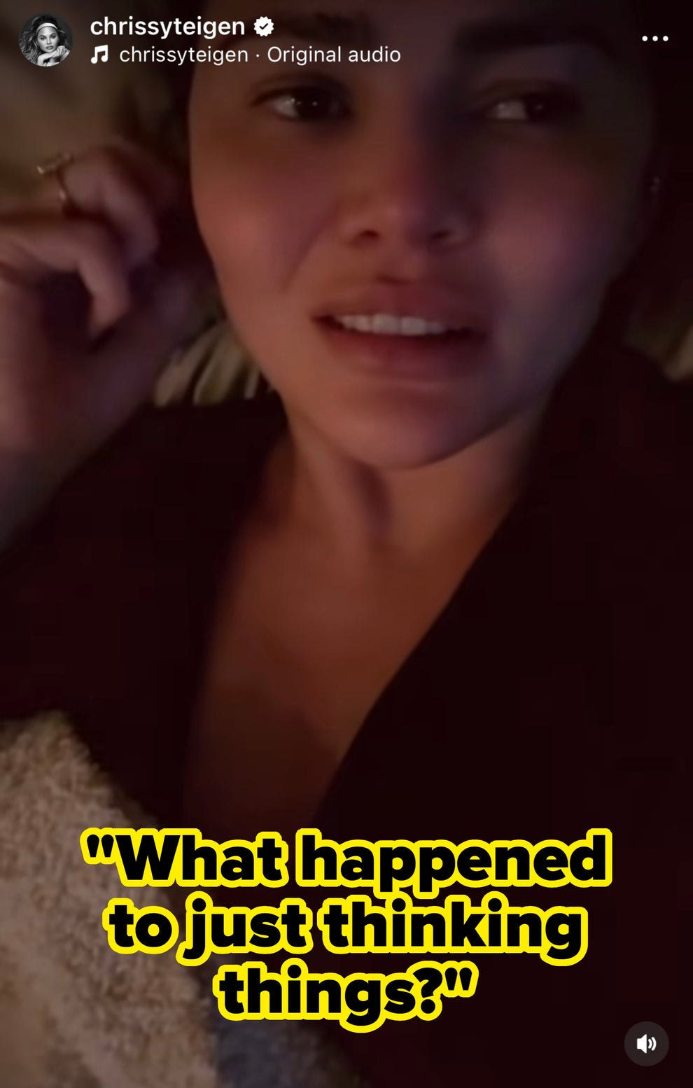 Chrissy Teigen Responds To Filler Speculation