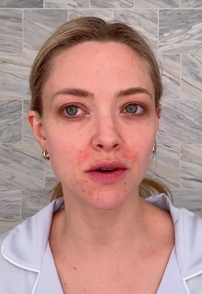 Amanda Seyfried Shows Off Eczema, Natural Skin