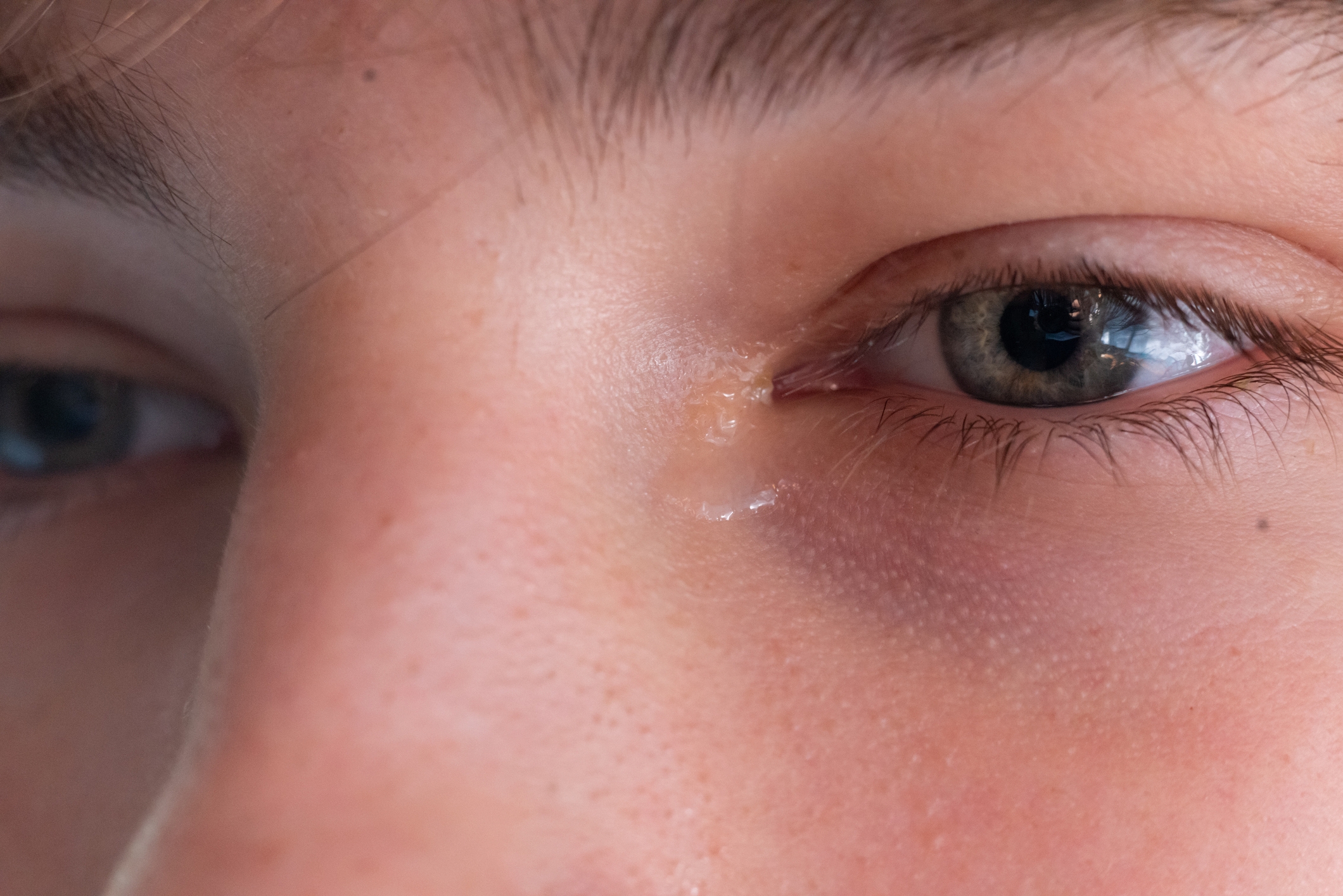 37 Body Quirks And Abnormalities People Have