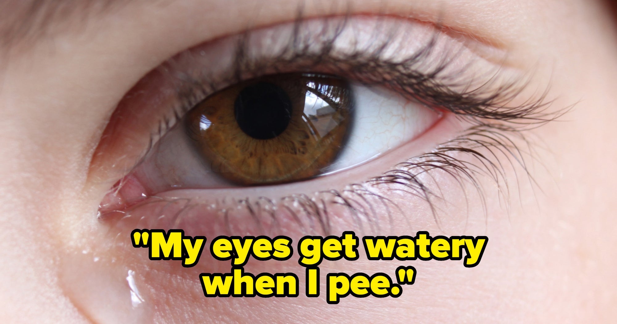 37 Body Quirks And Abnormalities People Have