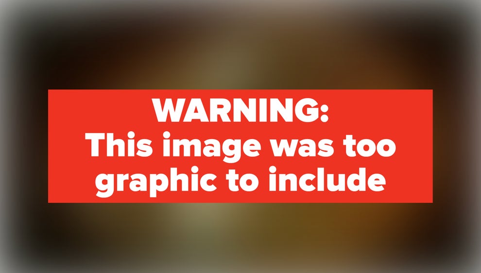 The Most Disgusting Human Body Facts Revealed