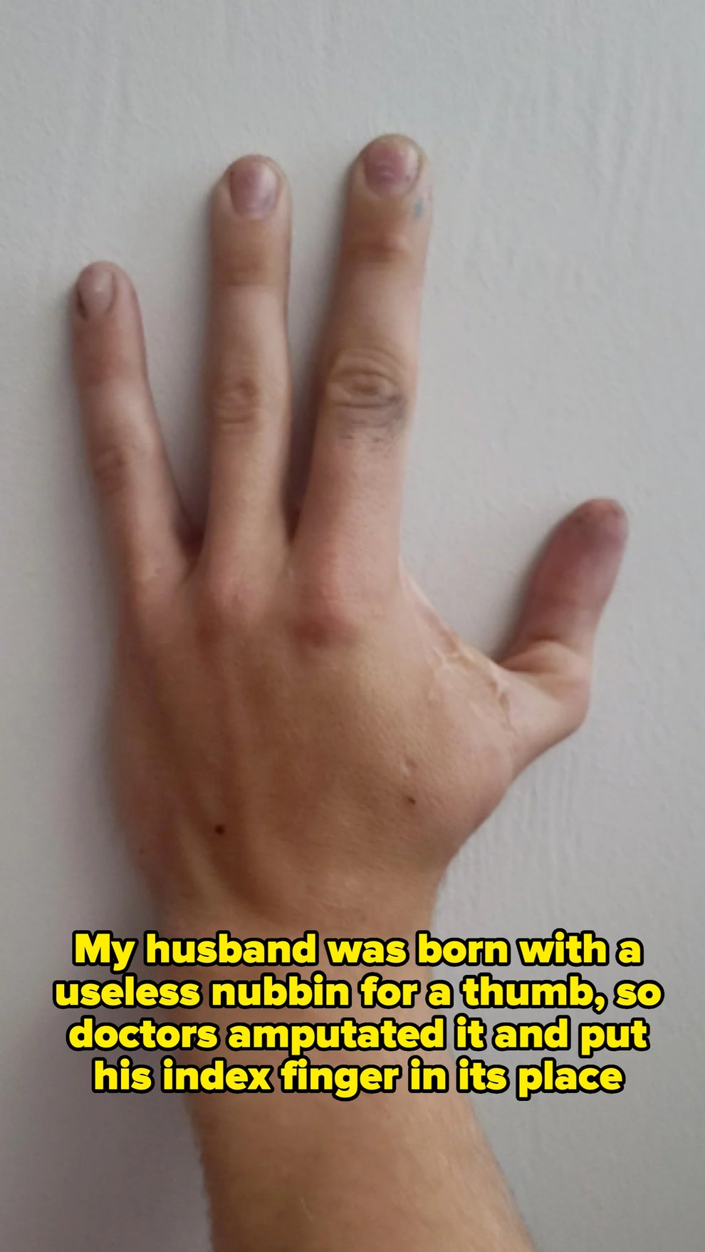 57 Fascinating Photos Of The Human Body