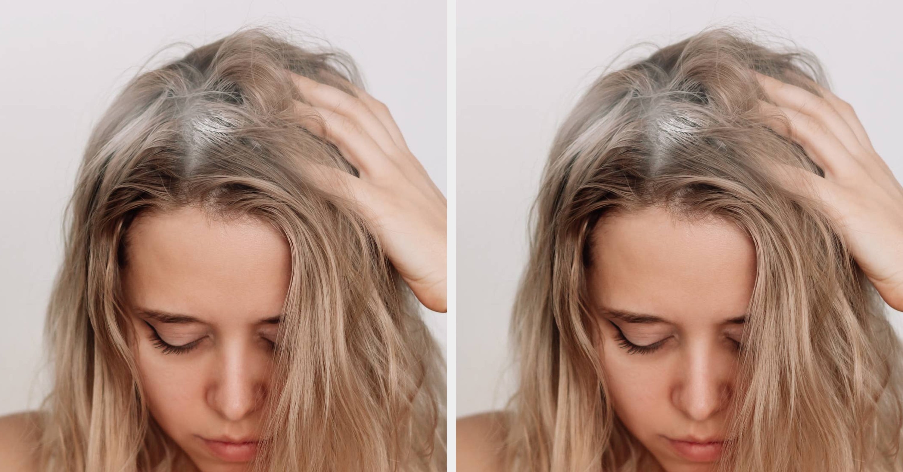 Stop Using Dry Shampoo Instead Of Washing Hair
