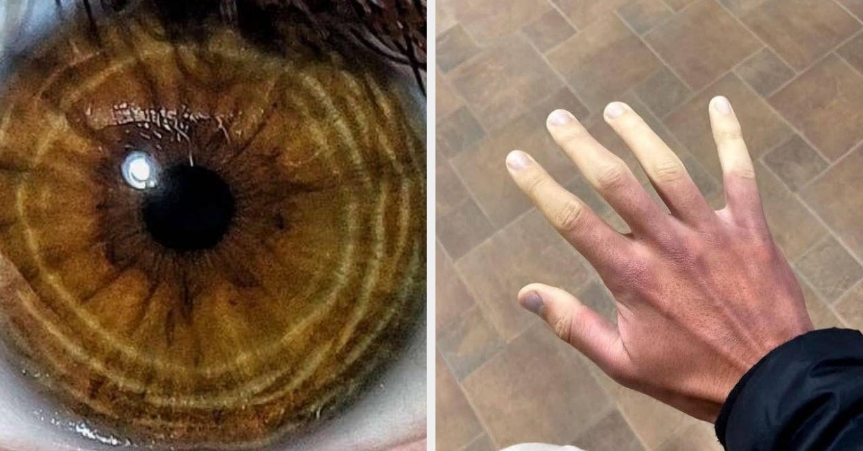 19 Weird Body Quirks People Shared Online