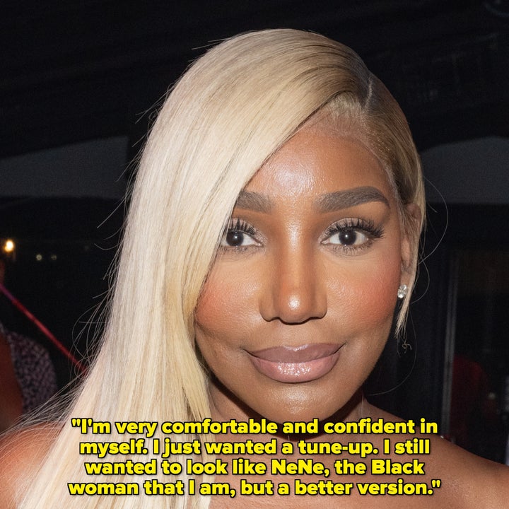 Celebrities Before And After Plastic Surgery