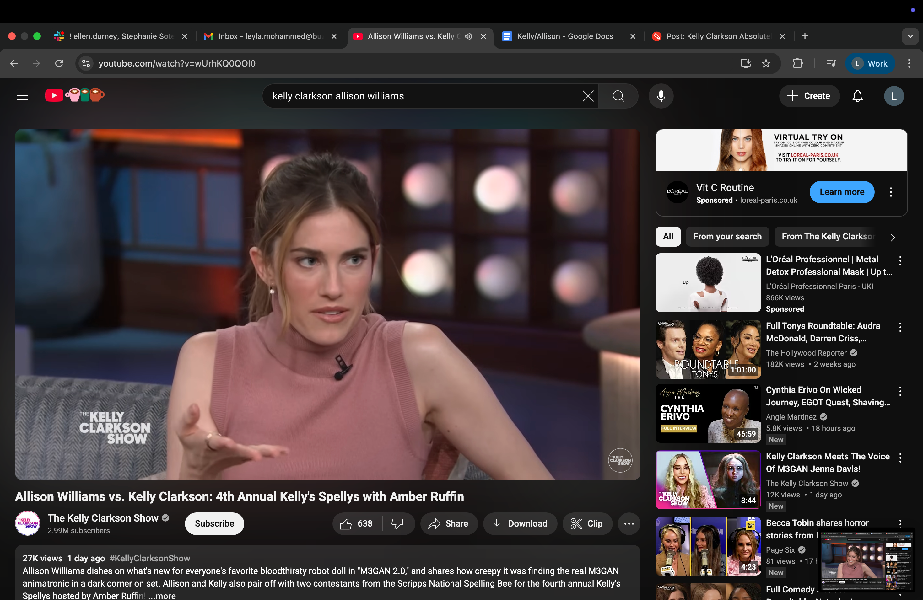 Kelly Clarkson Caught Staring At Allison Williams Botox