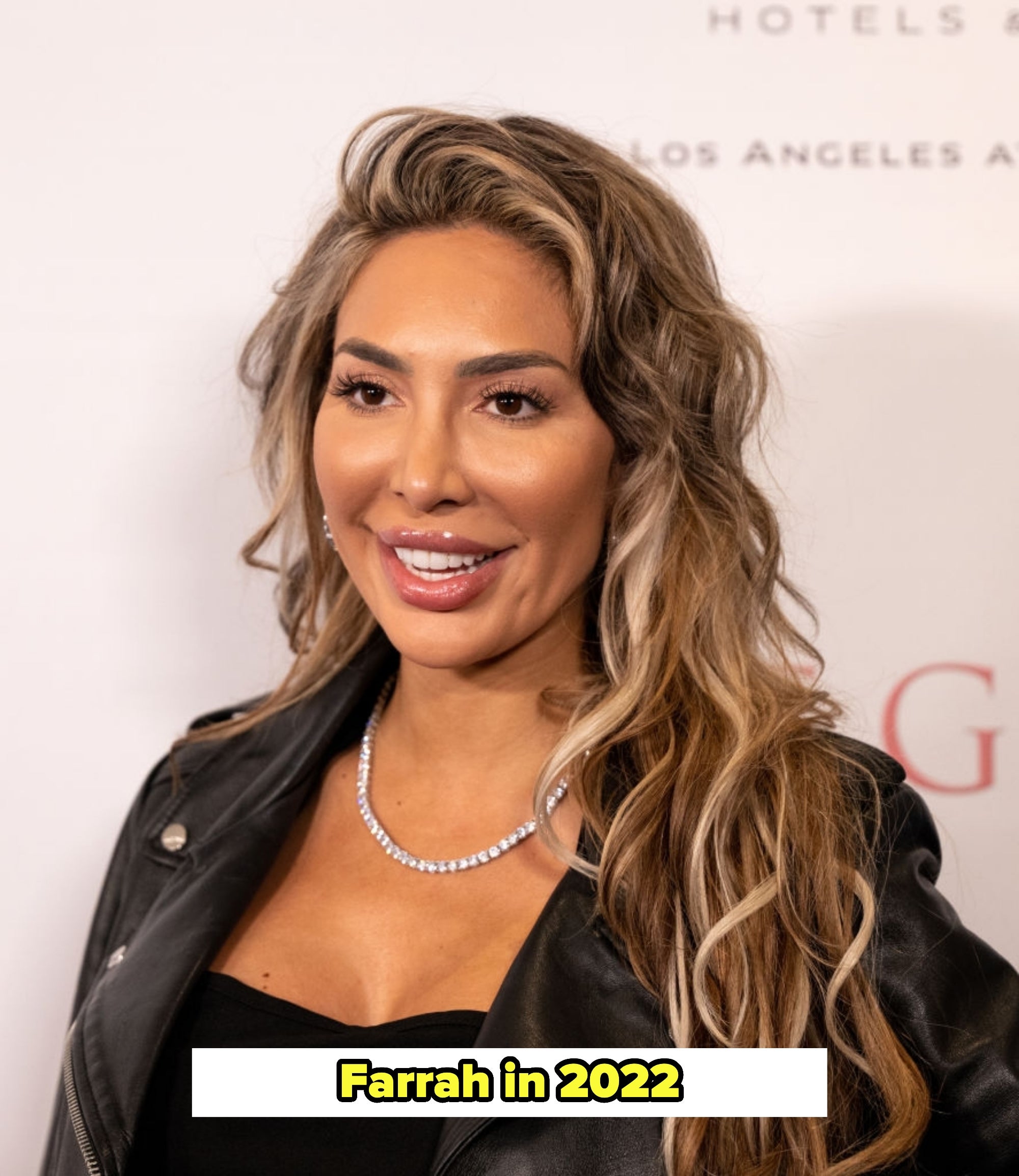 Celebrities Who Reversed Their Cosmetic Surgery