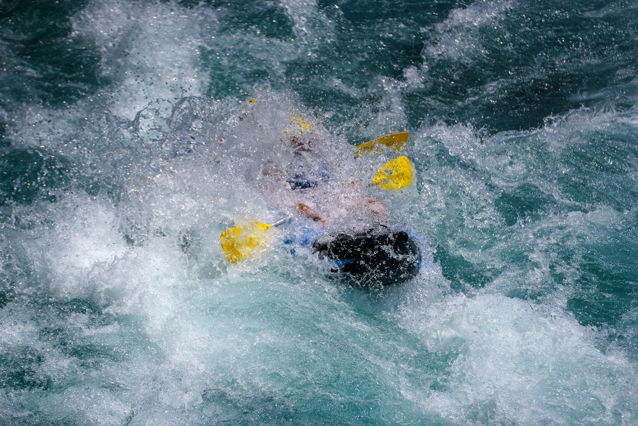 21 Near-Death Experiences People Survived By Sheer Luck