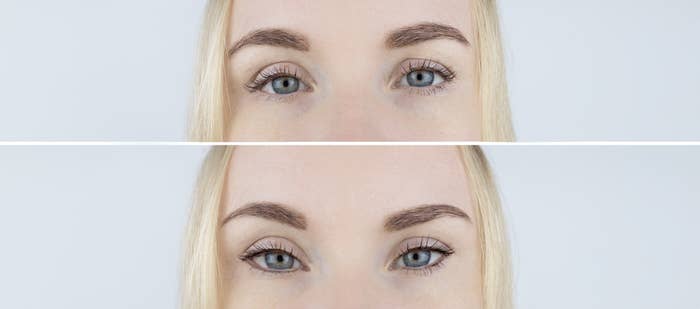 Patsy Field Posts Fox Eye Surgery Results