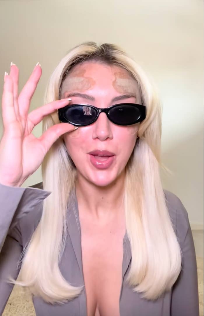 Patsy Field Posts Fox Eye Surgery Results