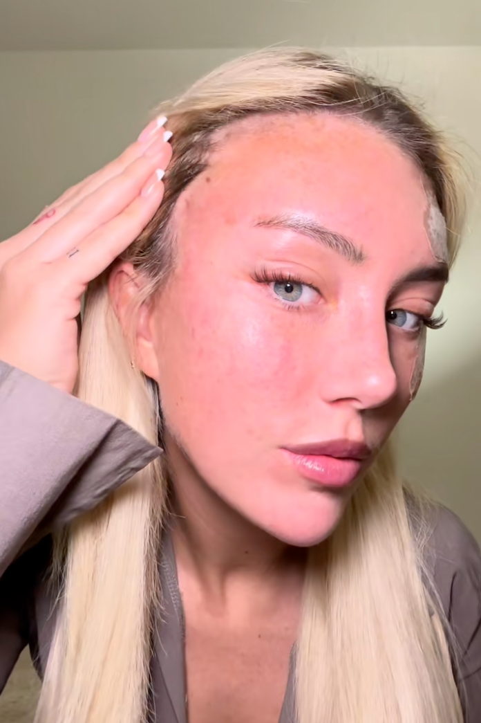 Patsy Field Posts Fox Eye Surgery Results