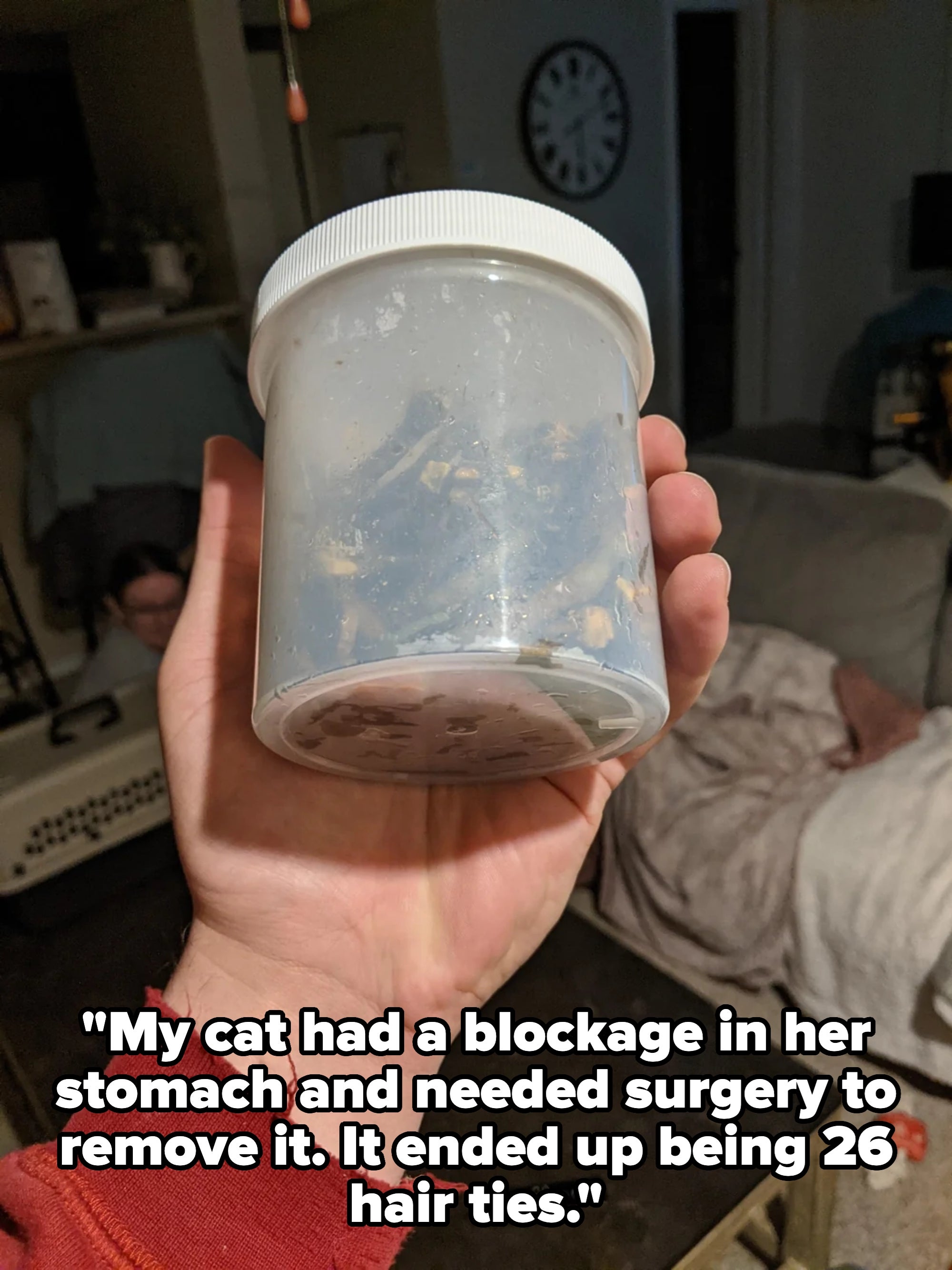 19 Astonishing Pictures Of Things Extracted From Bodies