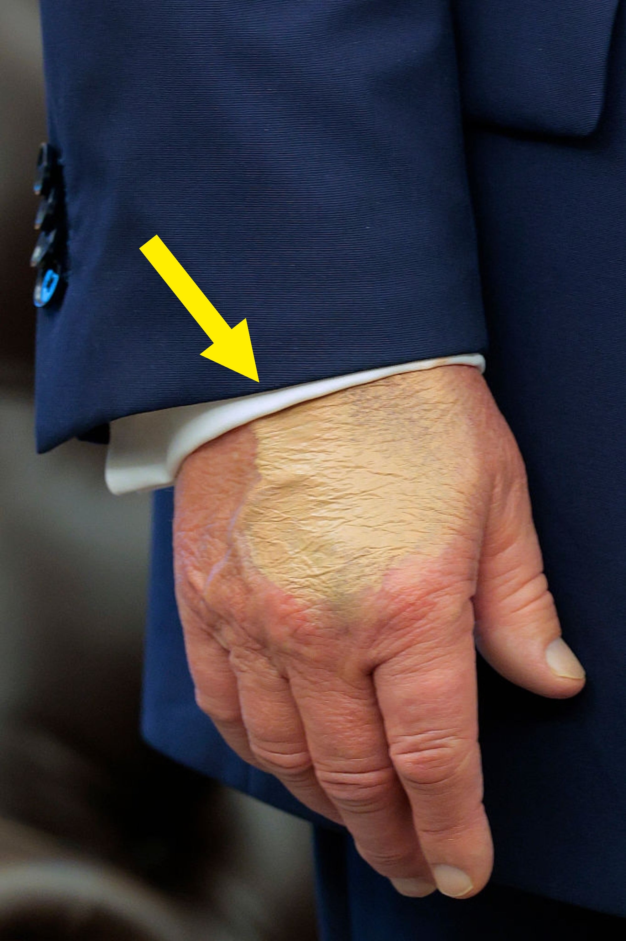 Photos Of Donald Trump's Hands Are Going Viral