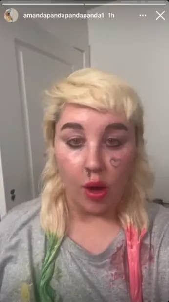 Amanda Bynes Shares Ozempic Update