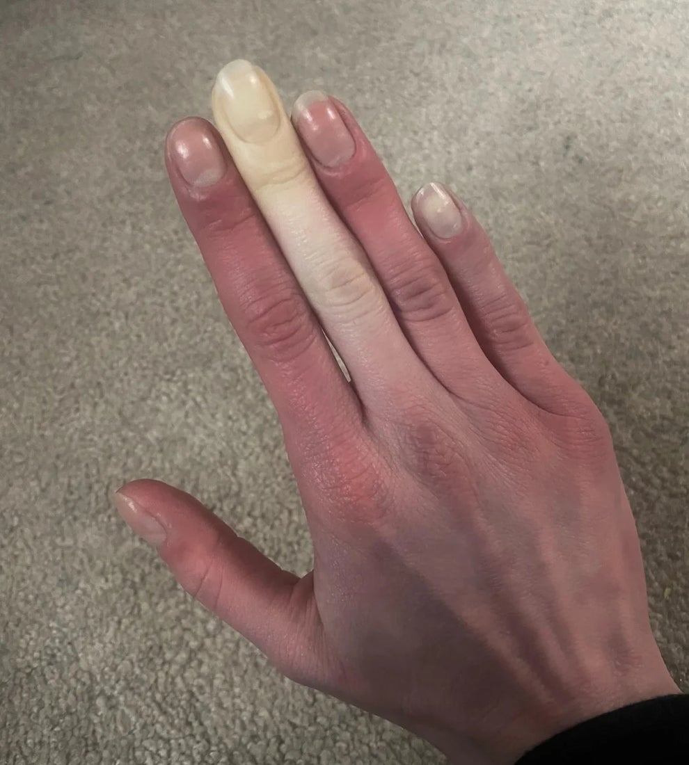 33 Shocking Body Anomalies People Thought Were Normal