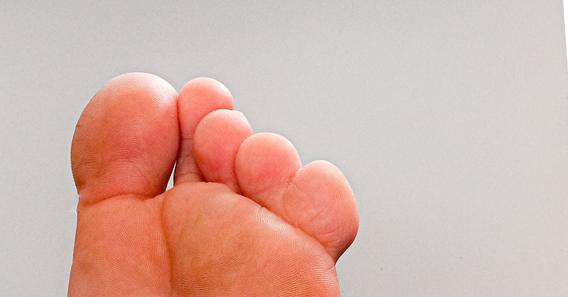 33 Shocking Body Anomalies People Thought Were Normal