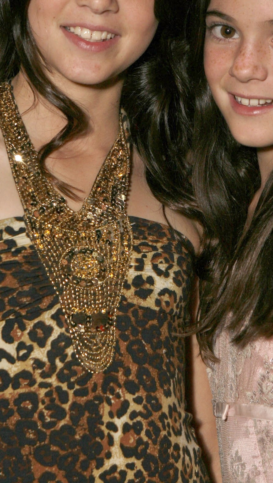 Kardashian-Jenners, Before And After Photos