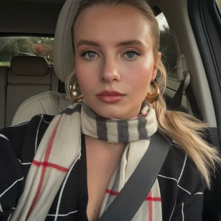 Reddit Woman's Non-Surgical Facial Transformation