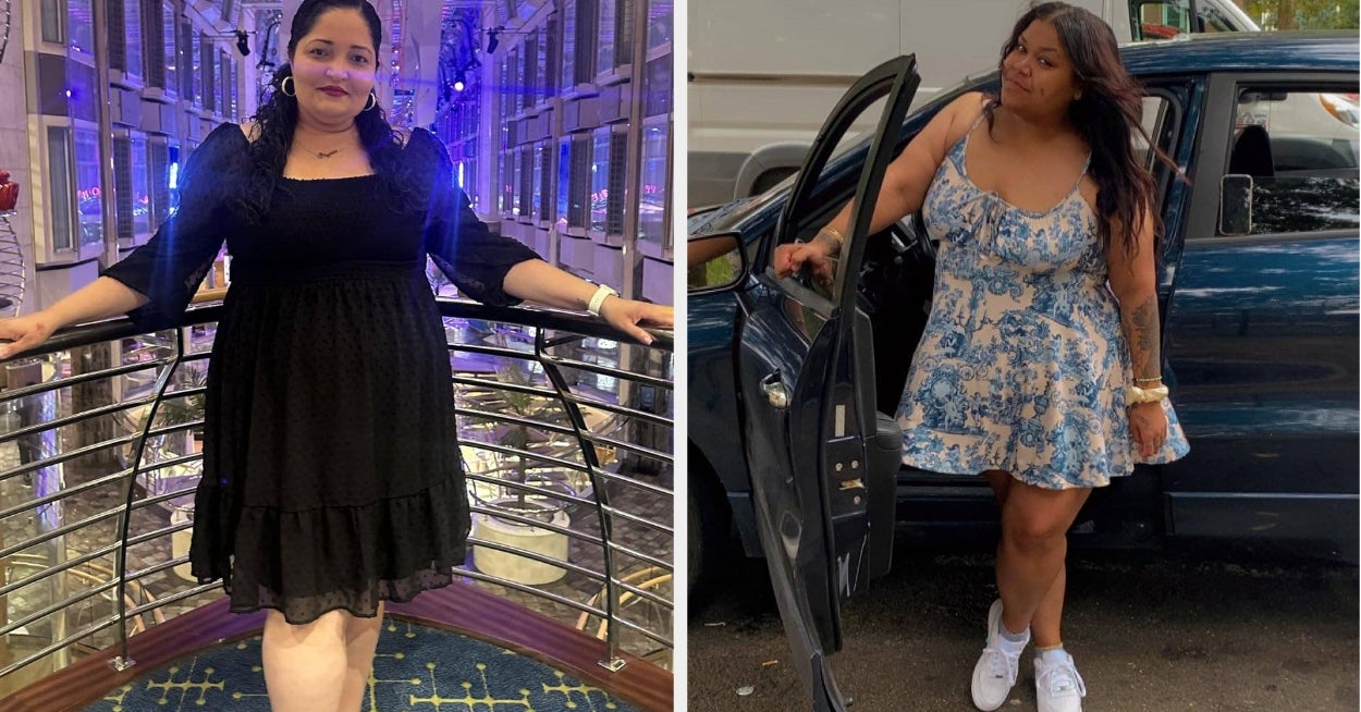 31 Dresses For Showing Your Legs Off