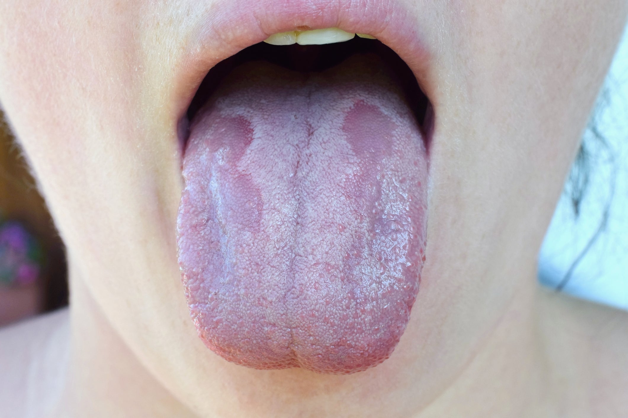 36 Rare Medical Diseases